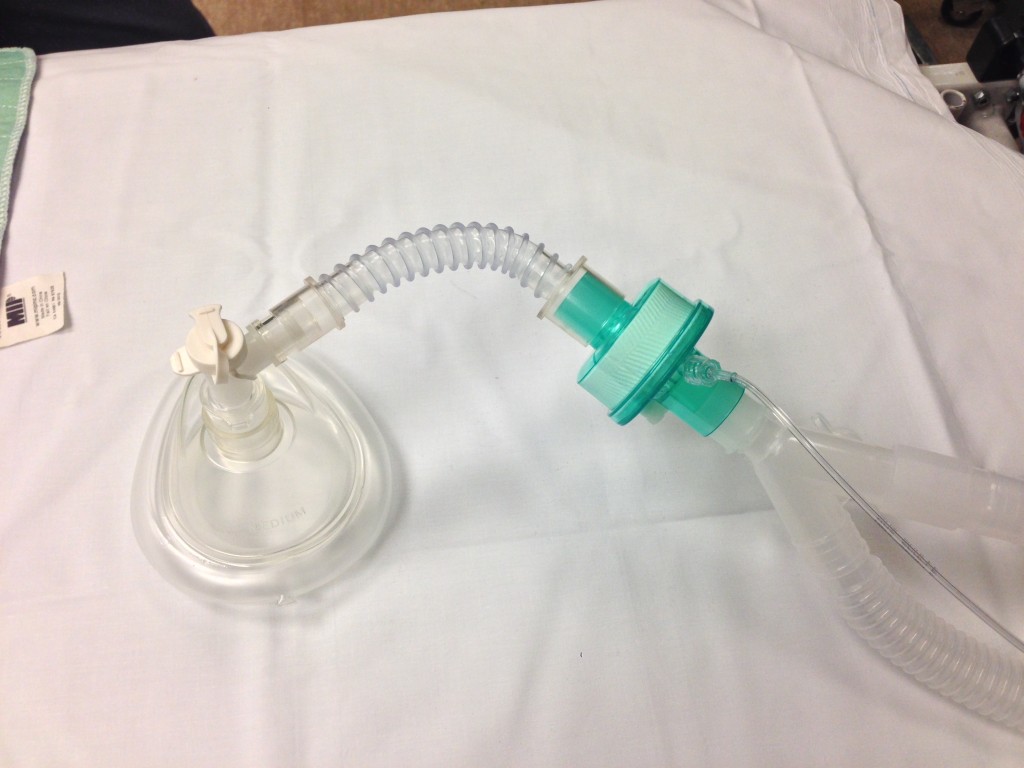 SOCMOB How To: Using the Ventilator for DSI with Dave Lendrum - SOCMOB Blog